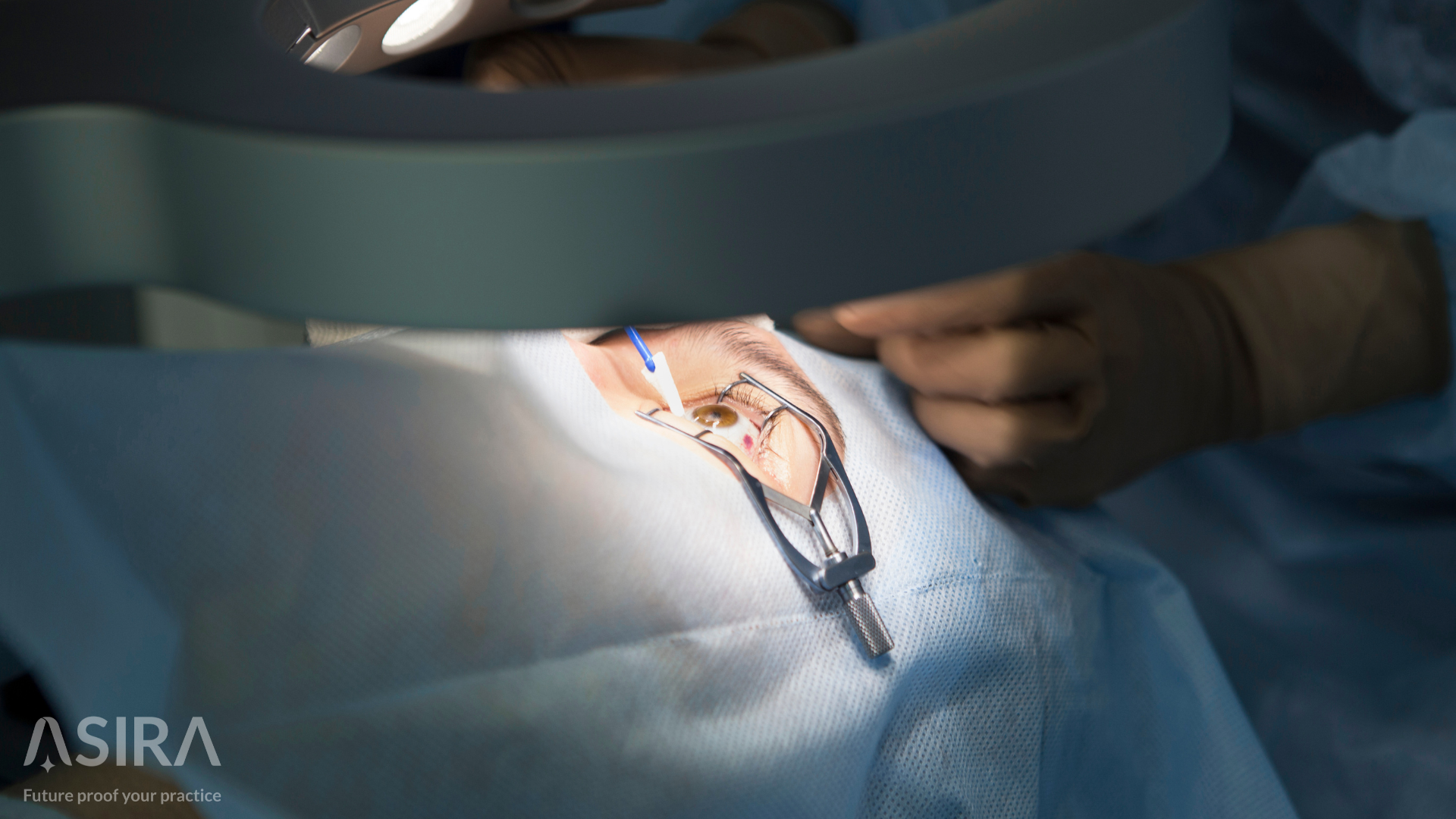 How to Advise Your Patient About Refractive Surgery